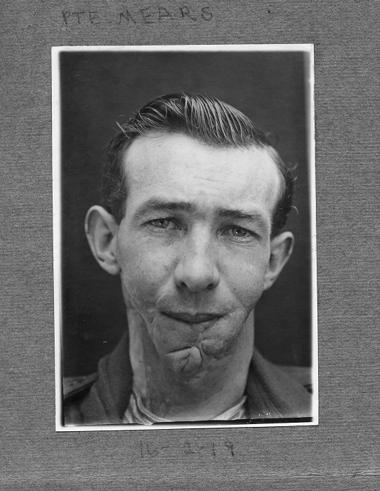 Centenary of ANZAC - Private Arthur Albert Mears